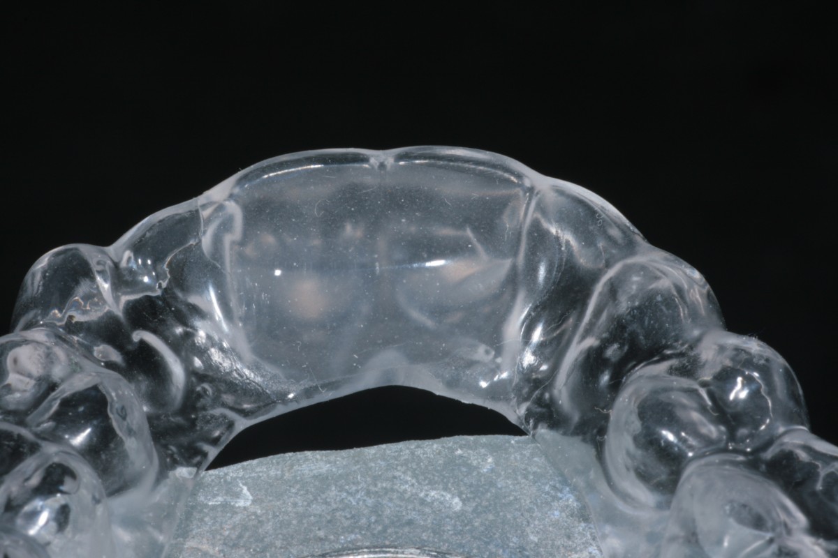 Schienentechnik | Thumfart's Zahntechnik GmbH