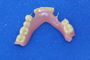 Herausnehmbarer ZE -Totalprothesen - Teilprothesen - Thumfart's ...