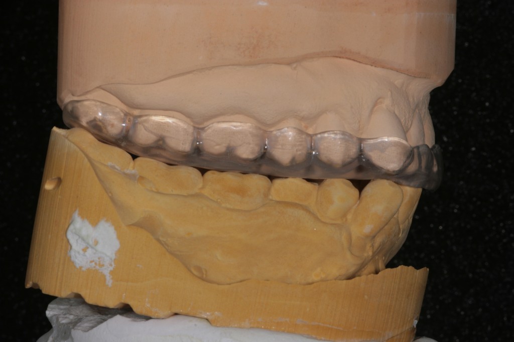 michiganschiene-017 - Thumfart's Zahntechnik GmbH