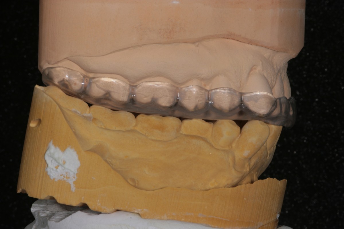 Schienentechnik - Thumfart's Zahntechnik GmbH