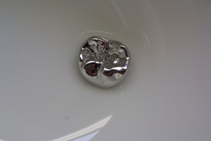 Festsitzender Zahnersatz | Thumfart's Zahntechnik GmbH