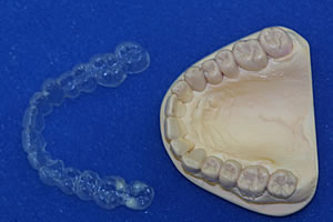 Schienentechnik | Thumfart's Zahntechnik GmbH